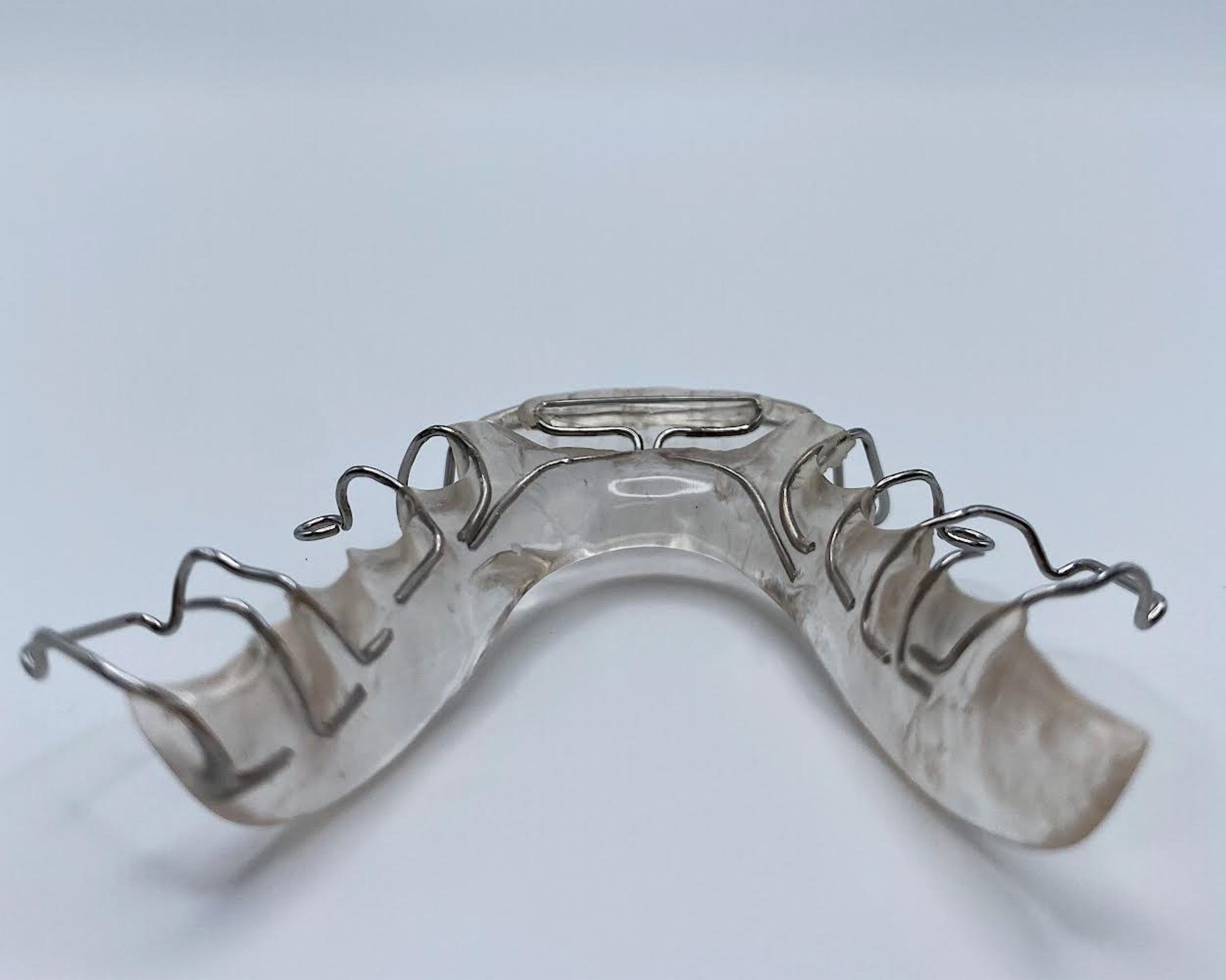 Spring Aligner – Splintortho